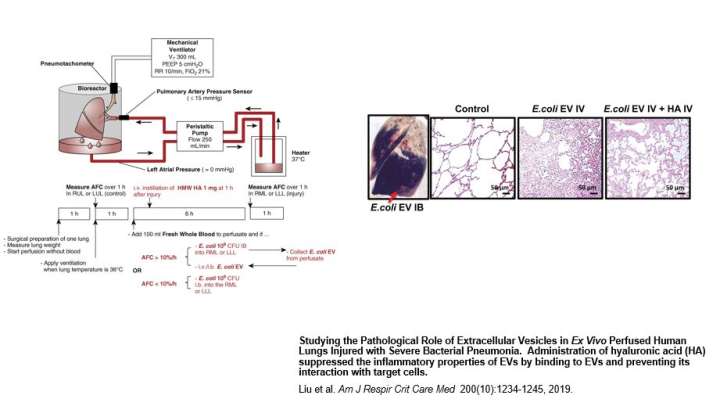 Research - Anesthesiology | UCLA Health