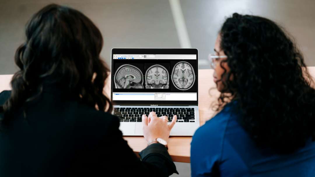 Map the Mind - Giving | UCLA Health