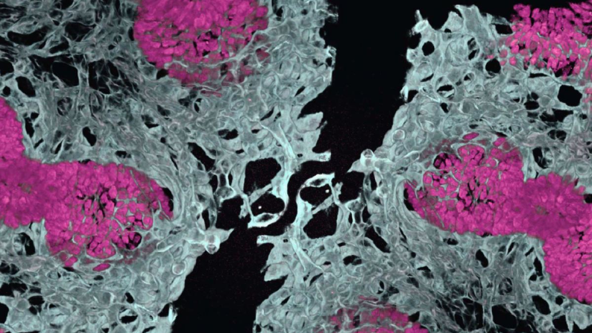 Scientists create first mini-lungs with built-in blood vessels | UCLA ...