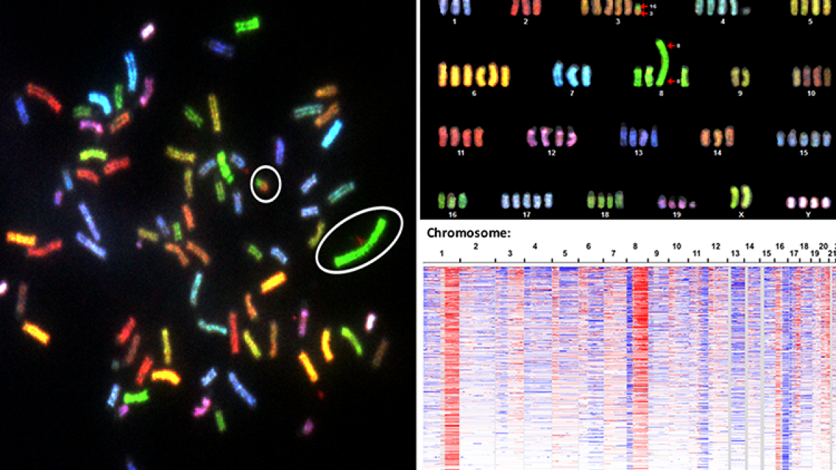DNA patterns can unlock how glucose metabolism drives cancer, study ...