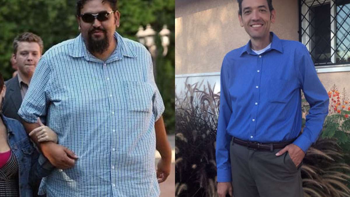 Neil's Story - Gastric Sleeve | UCLA Health