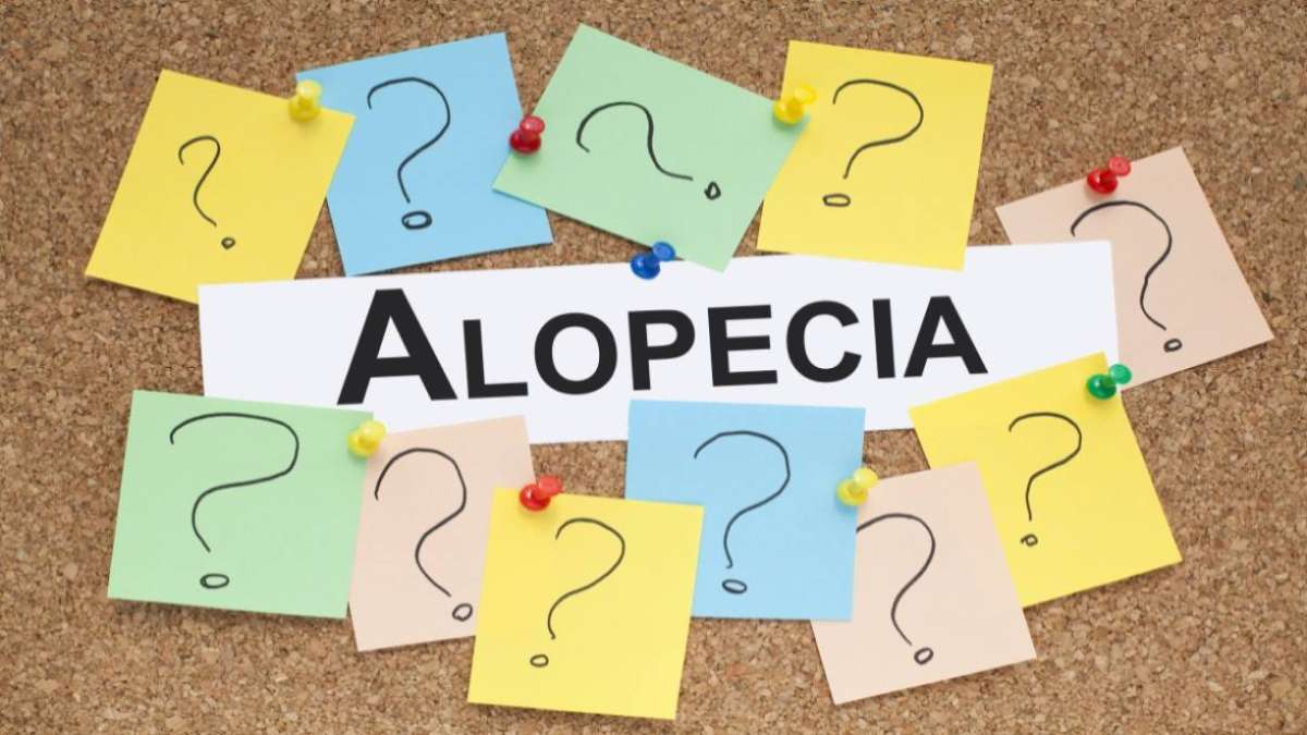 What is alopecia areata? | UCLA Health
