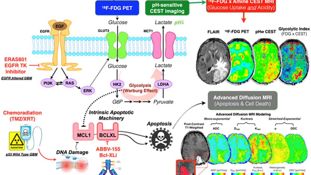 Taking brain cancer science from discovery to novel clinical trials ...