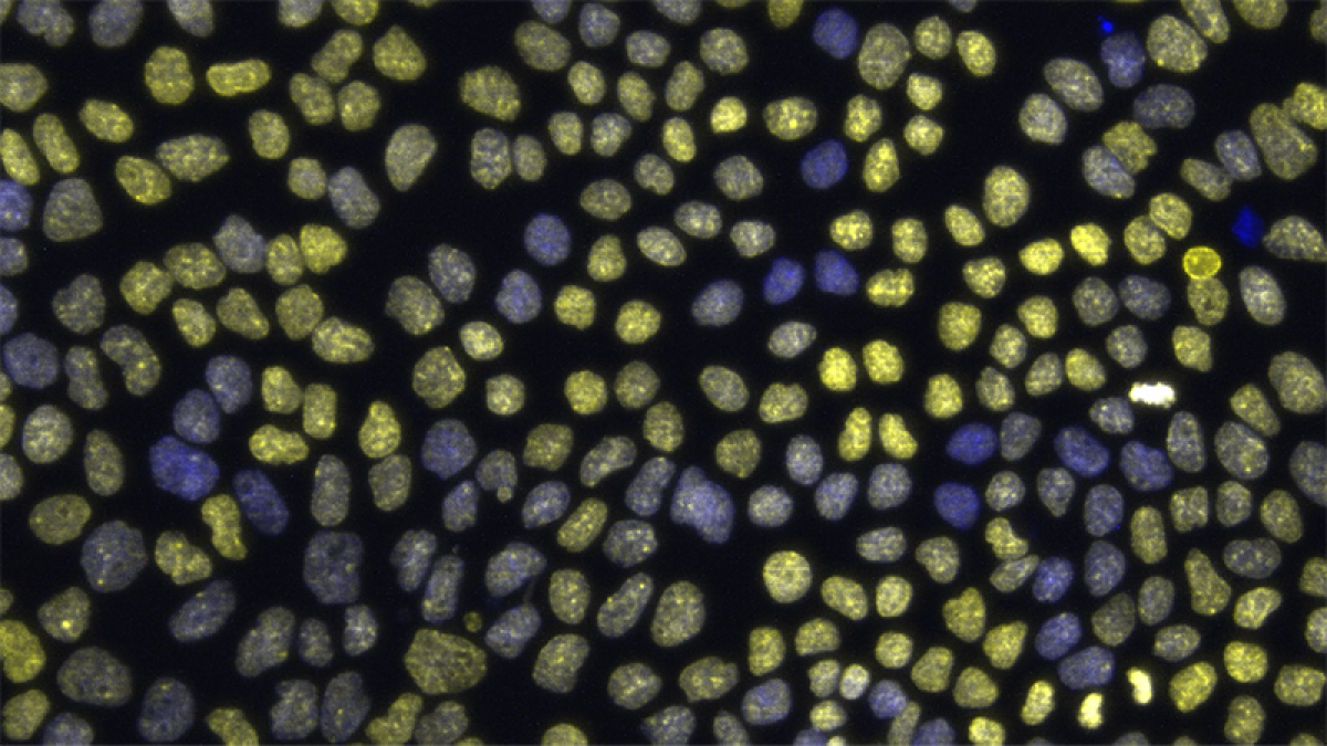 Does cell nucleus size matter in gene activity? Researchers say yes ...