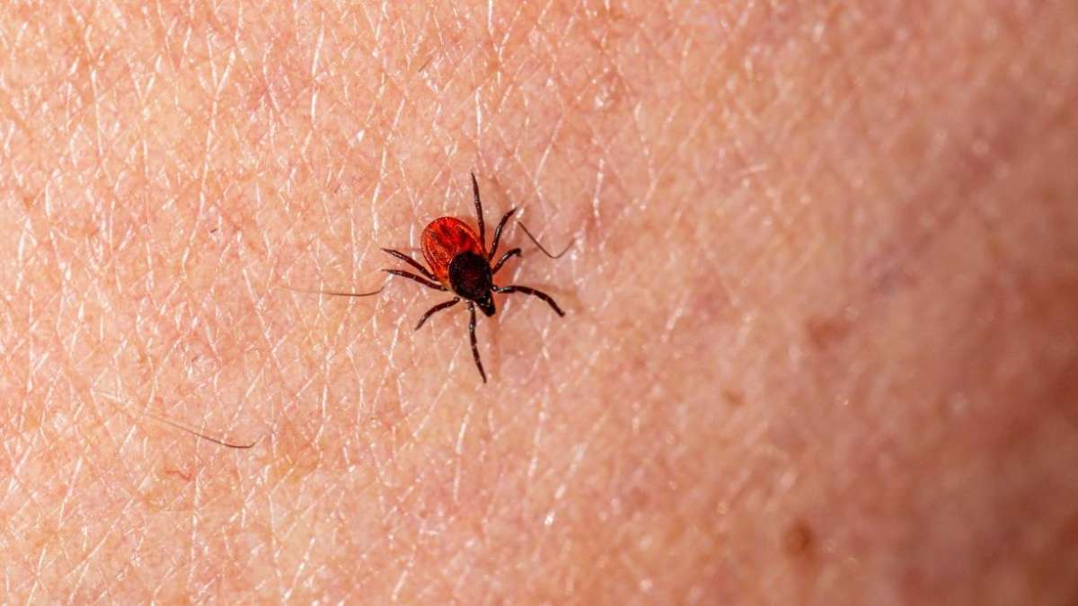 Getting a tick out quickly is top priority | UCLA Health