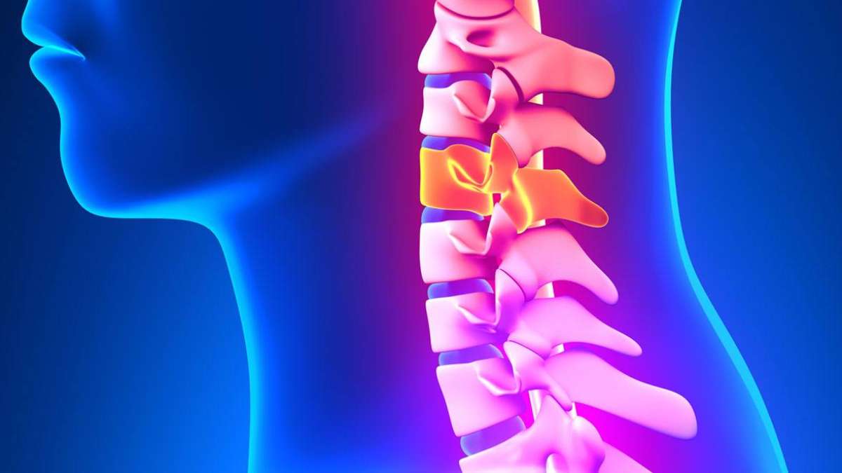 Cervical surgery relieves mystery itch | UCLA Health