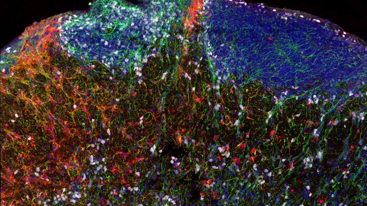 UCLA scientists awarded $10 million by NIH to study developing brain ...