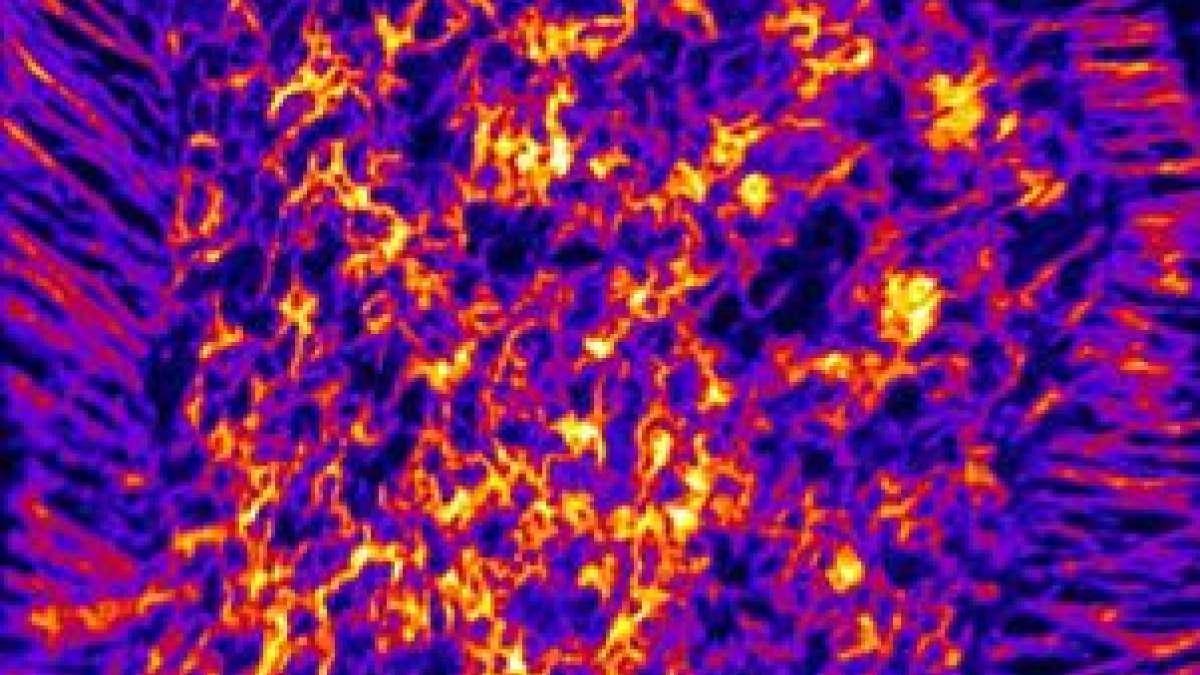 Researchers explore a new method to study cholesterol distribution on ...