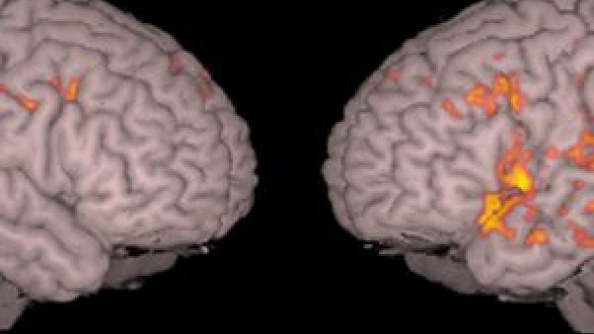 Distorted self-image the result of visual brain glitch, study finds ...