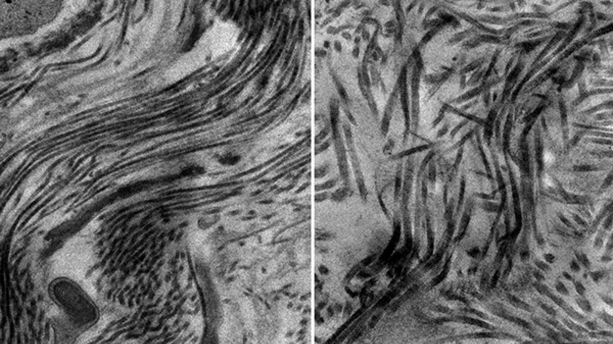 How the body regulates scar tissue growth after heart attacks | UCLA Health