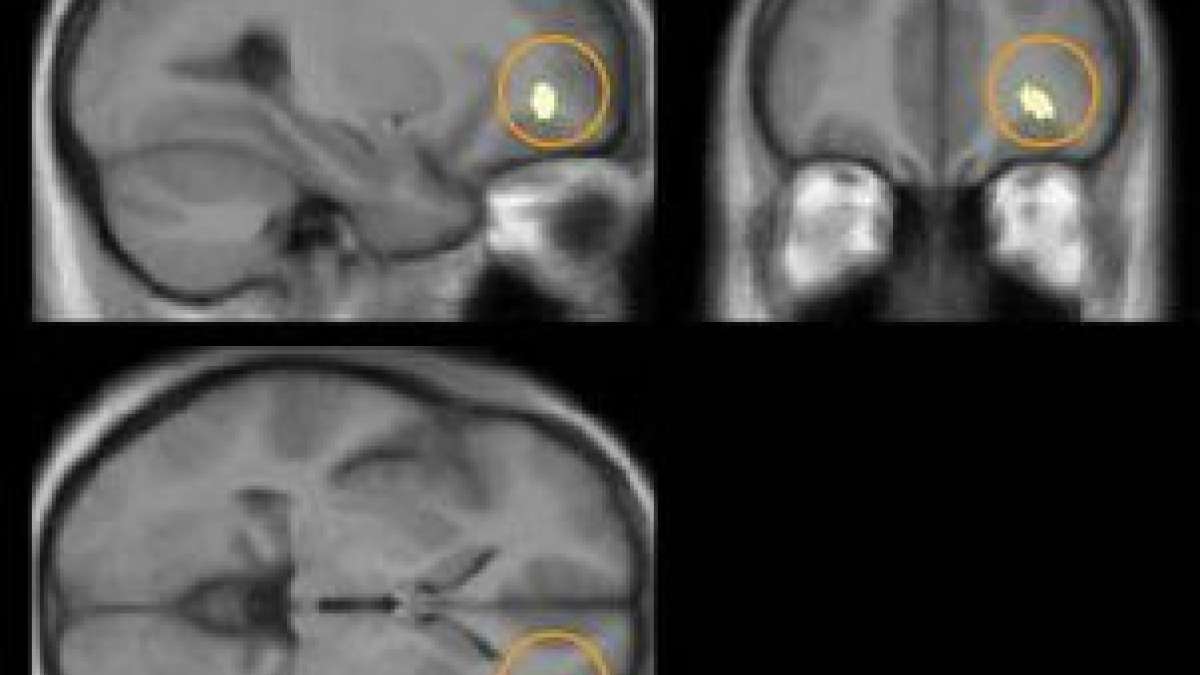 How to build a bigger brain | UCLA Health