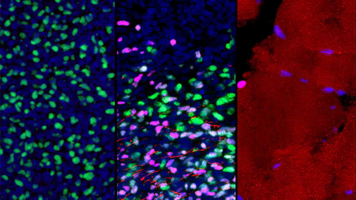 UCLA scientists create first roadmap of human skeletal muscle ...