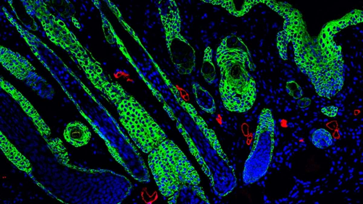 New Wound-Healing Biomaterials Reduce Scarring and Promote Tissue ...