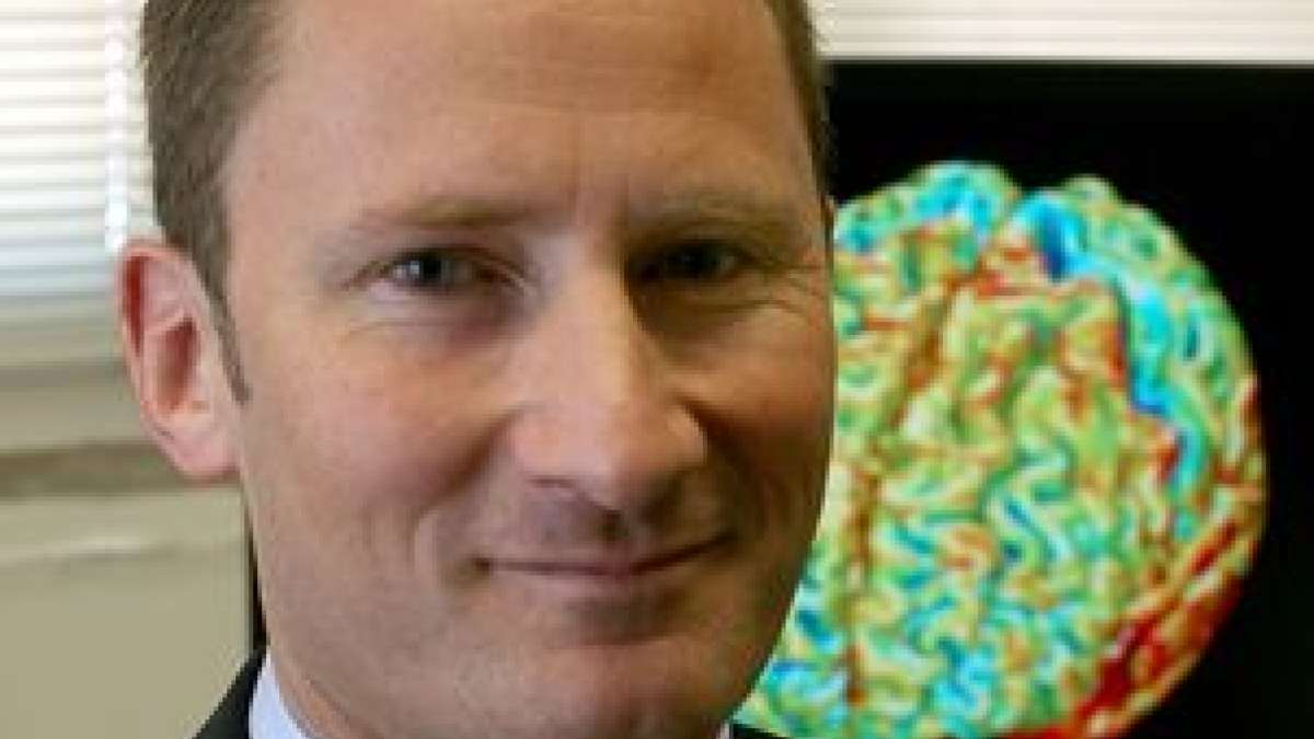 More evidence that male and female brains are wired differently | UCLA ...