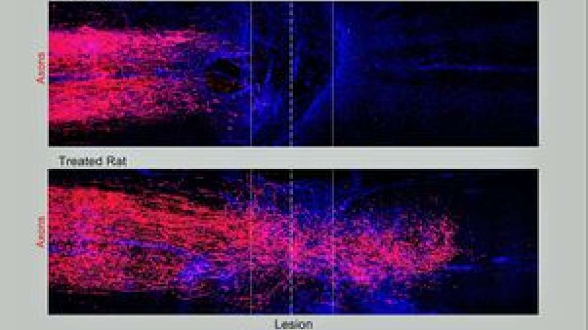 New therapy spurs nerve fibers to regrow through scar tissue, transmit ...