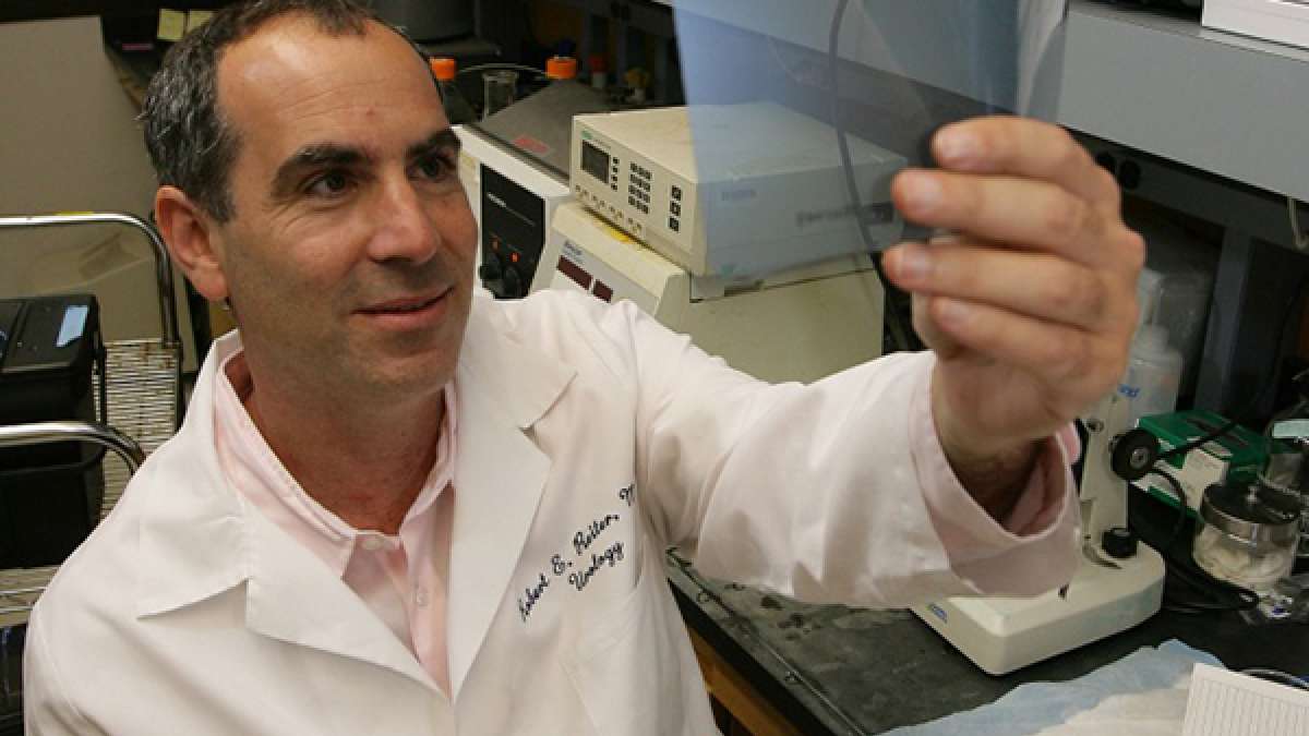 MRI frequently underestimates tumor size in prostate cancer | UCLA Health