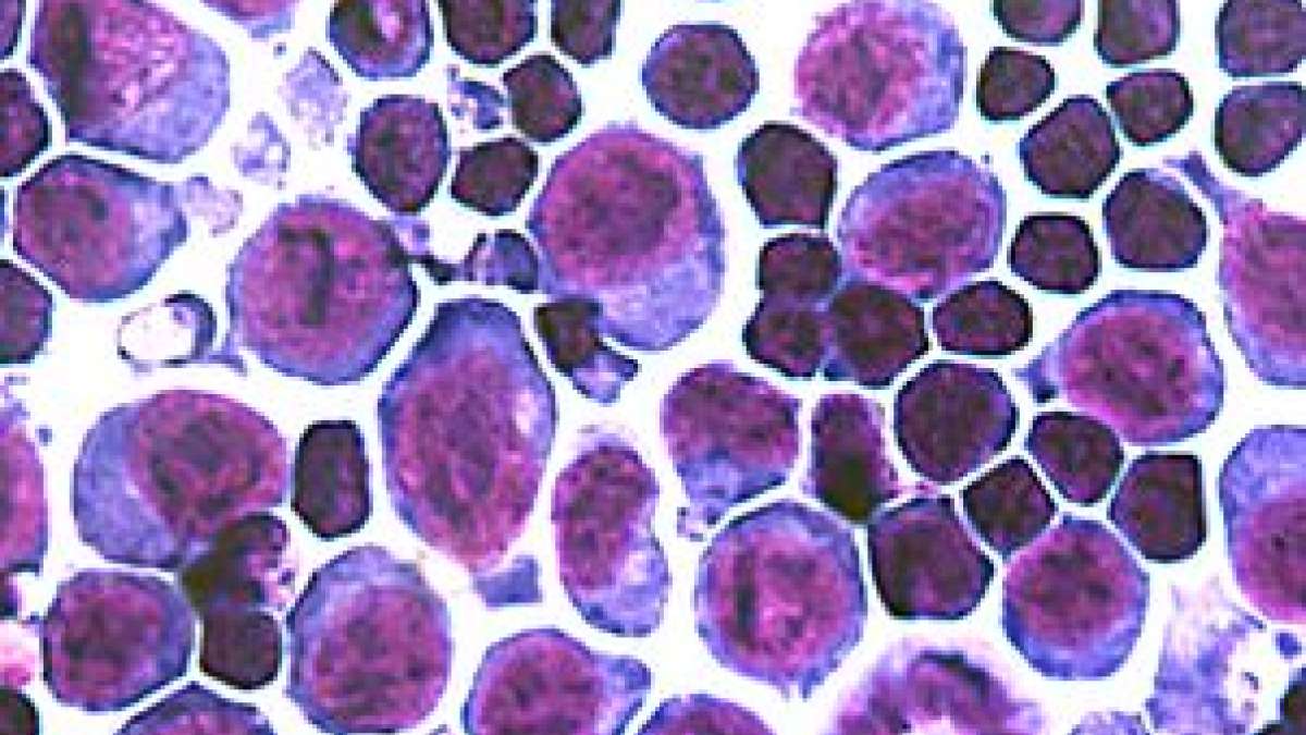 Researchers discover hormone that controls supply of iron in red blood ...