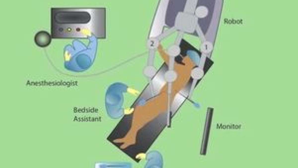 Robot-assisted technique improves surgeons' ability to remove small ...