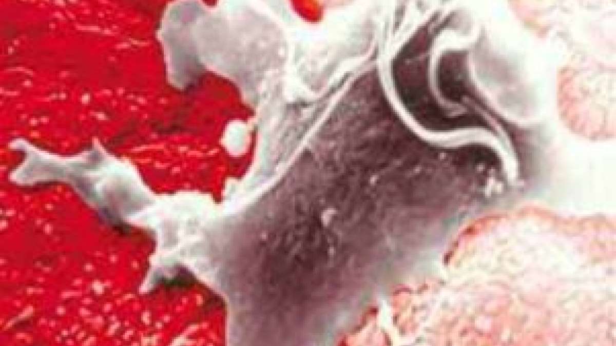 STD may heighten risk of prostate cancer | UCLA Health