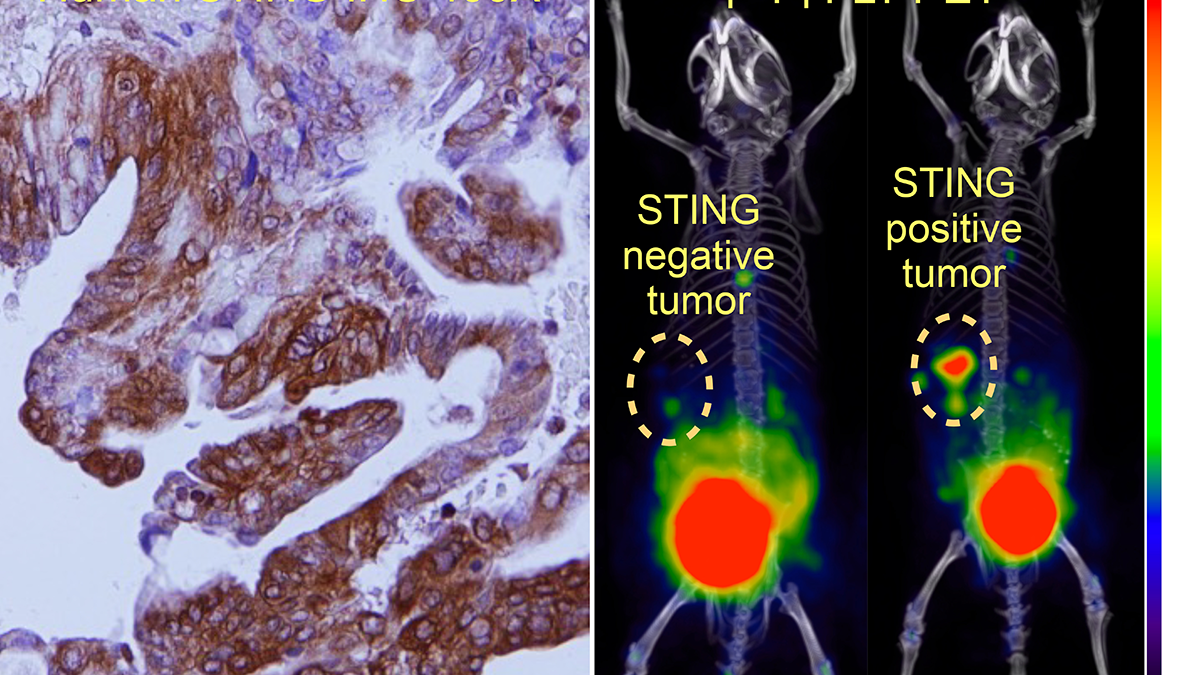 Researchers identify a mechanism that can help guide the development of ...