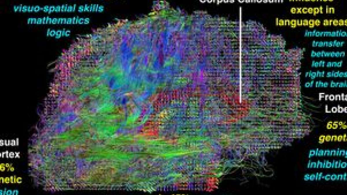 Study gives more proof that intelligence is largely inherited | UCLA Health
