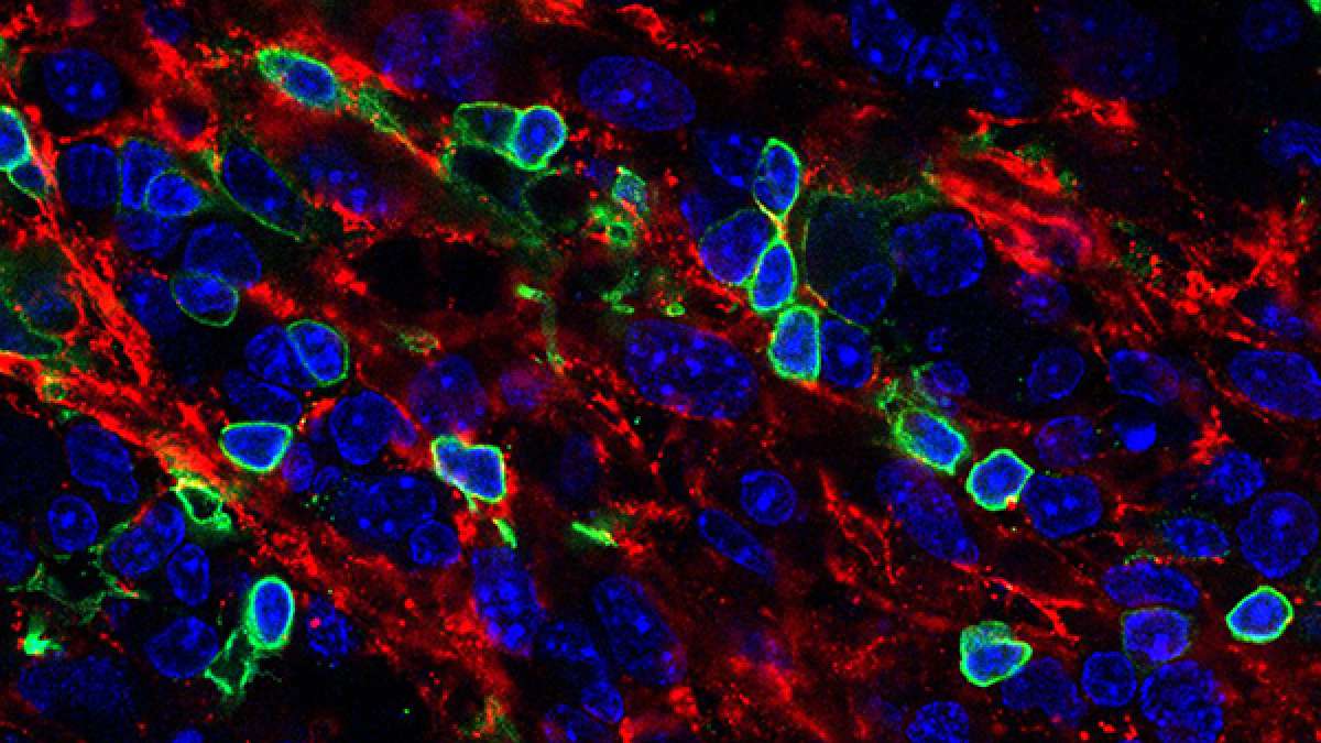 UCLA researchers create millions of diverse T cells from a single blood ...