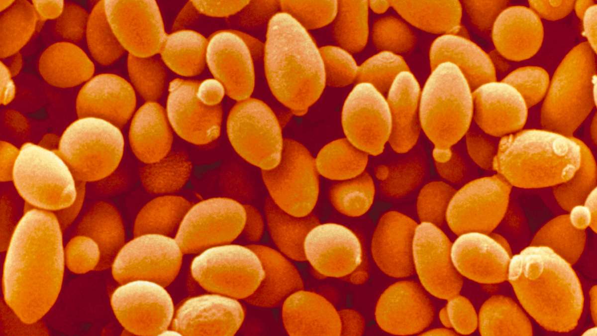What the Yeast Can Tell Us | UCLA Health