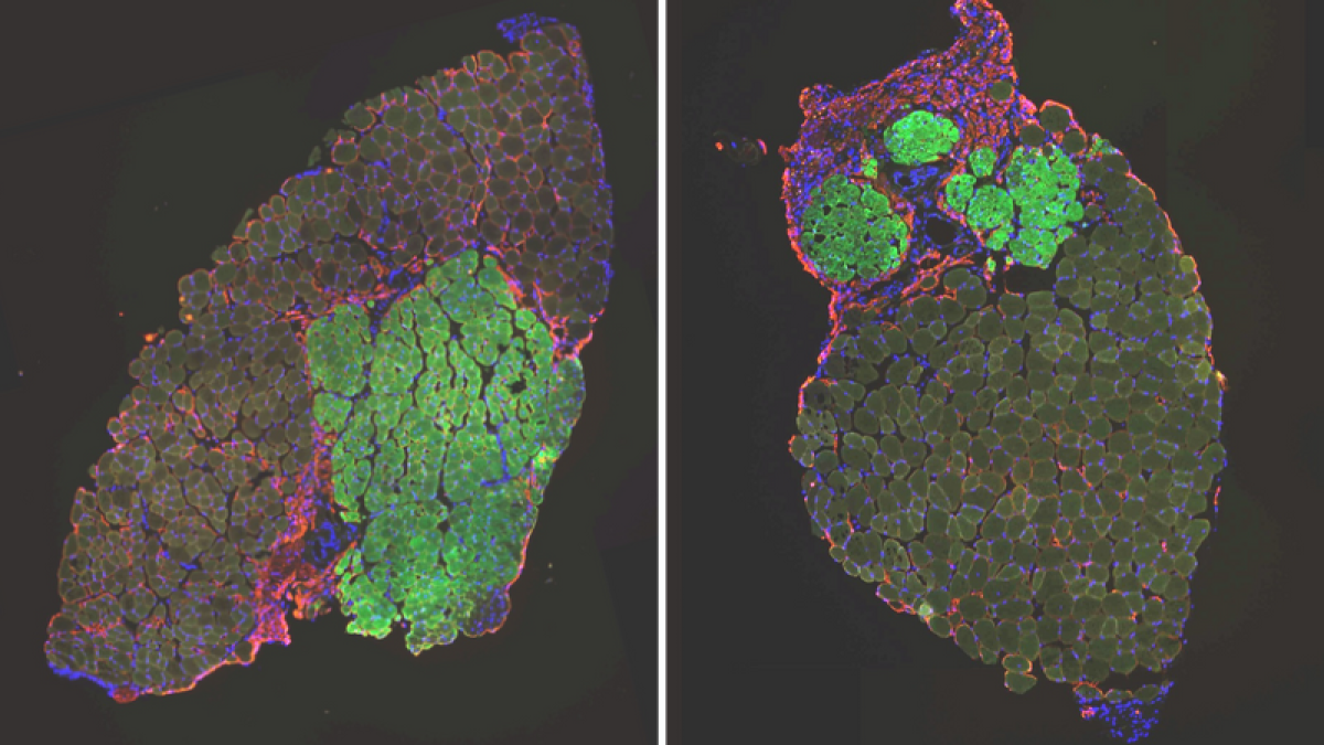 Scientists identify a method to rejuvenate old stem cells | UCLA Health