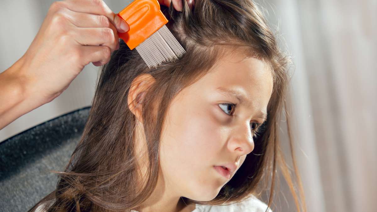Managing head lice outbreaks: What California parents need to know ...