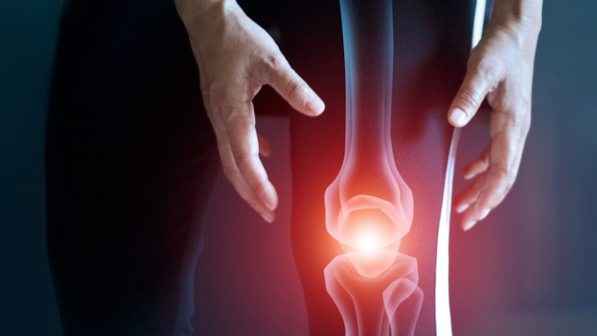 Pain in knee suggests mild MCL injury | UCLA Health