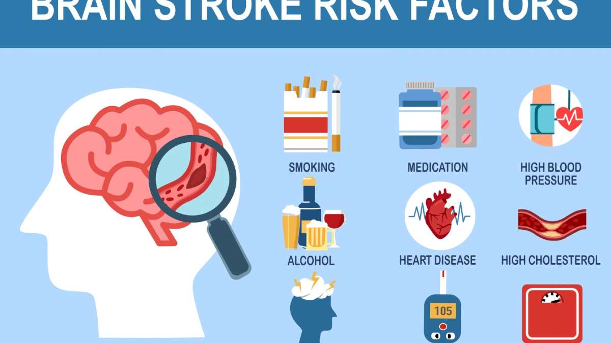 Risk of stroke is up worldwide. What can be done about it? | UCLA Health