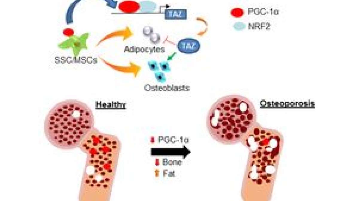 UCLA researchers discover gene that controls bone-to-fat ratio in bone ...