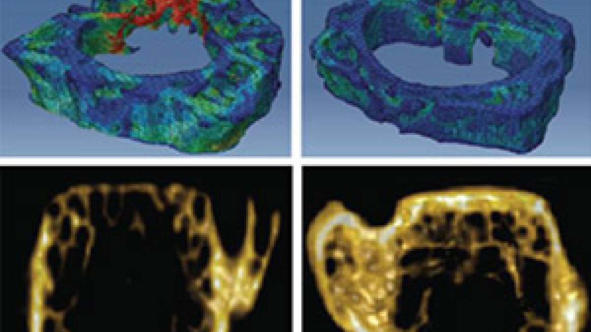 UCLA study reveals bone-building protein’s impact on bone stem cells ...
