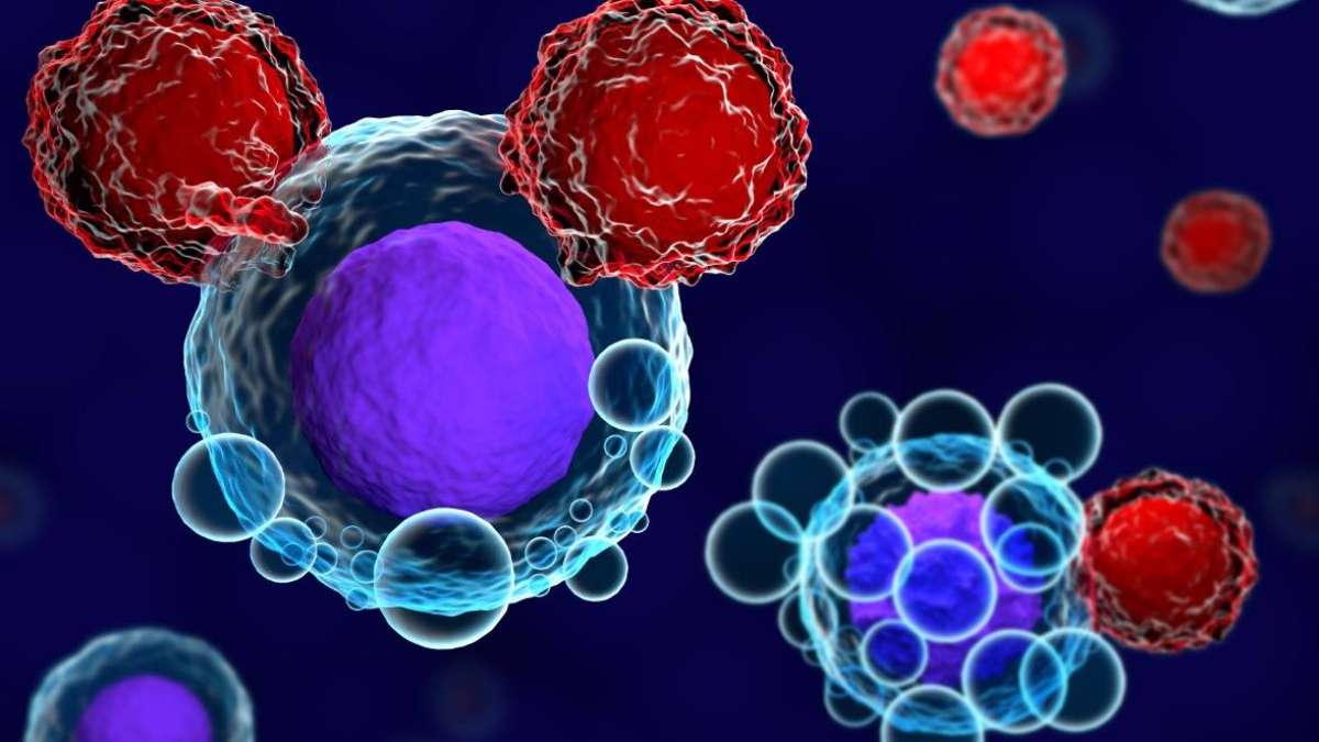 More research needed in promising lupus CAR T-cell therapy | UCLA Health
