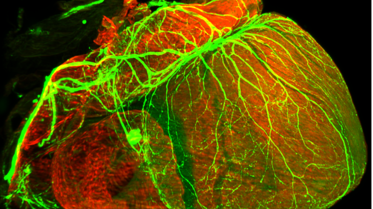 Leducq-funded transatlantic network set to pioneer new diagnosis and ...