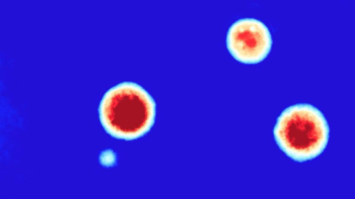Fine-tuning 3D lab-grown mini tumors to help predict how patients ...