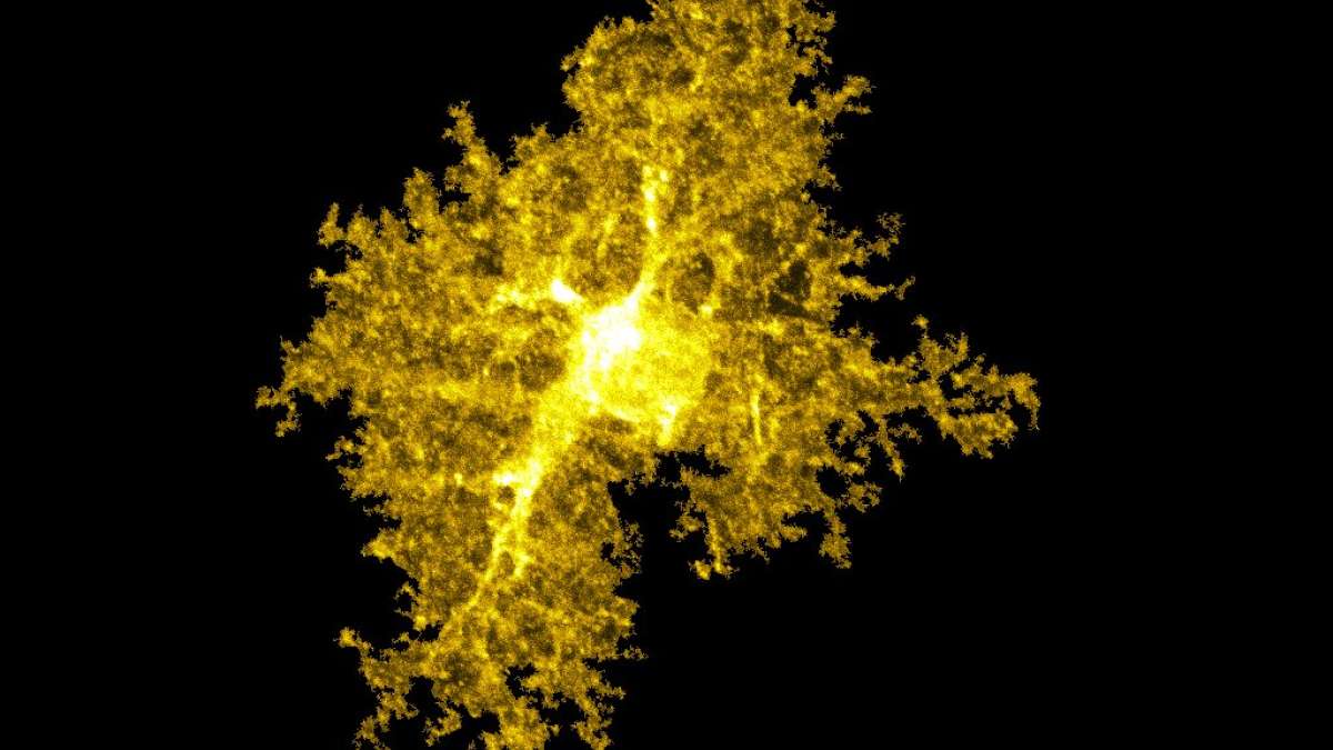 The brain’s support cells may play a key role in OCD | UCLA Health