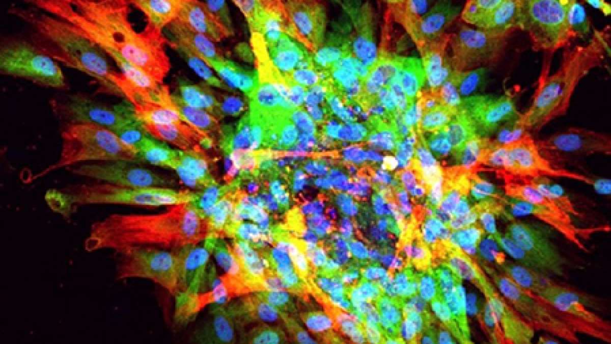 Researchers create accurate model of organ scarring using stem cells in ...