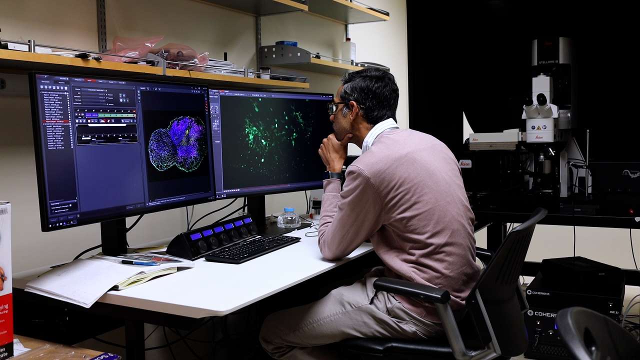 Brains of Neurology Lab Profiles - Neurology | UCLA Health