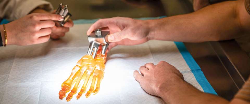 The ‘bionic possibilities’ of prosthetic advances | UCLA Health