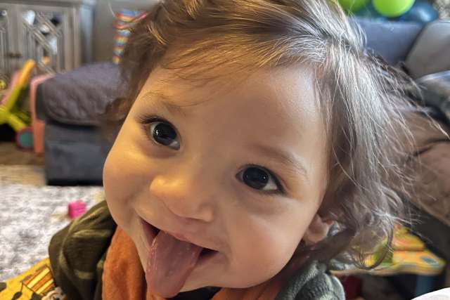 Craniofacial care team has young boy thriving after cleft lip and ...