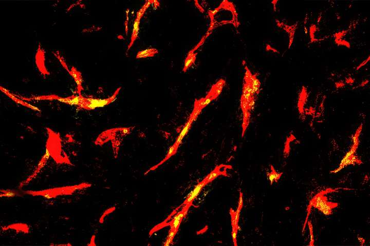 A low omega-6, omega-3 rich diet and fish oil may slow prostate cancer ...