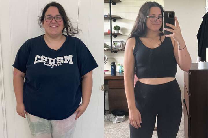 Joanna's Story - Gastric Bypass Surgery | UCLA Health