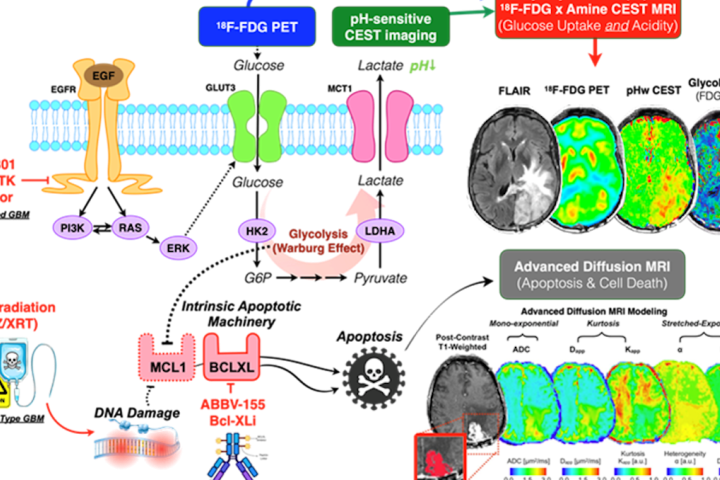 Taking brain cancer science from discovery to novel clinical trials ...