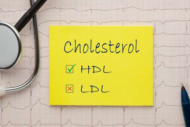 High cholesterol? Here's what to do about it | UCLA Health