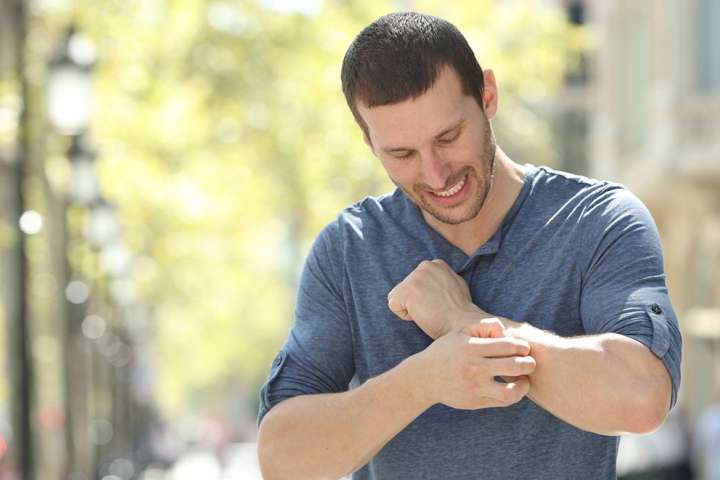 Effective treatments available for mild to severe psoriasis | UCLA Health