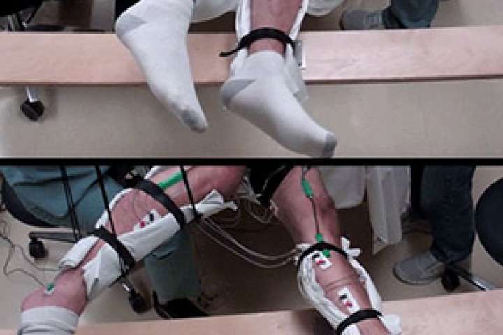 In UCLA study, non-surgical approach helps people with paralysis ...