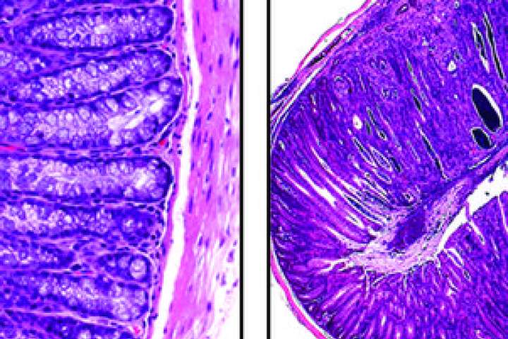 UCLA-led study identifies genetic factors involved in pediatric ...