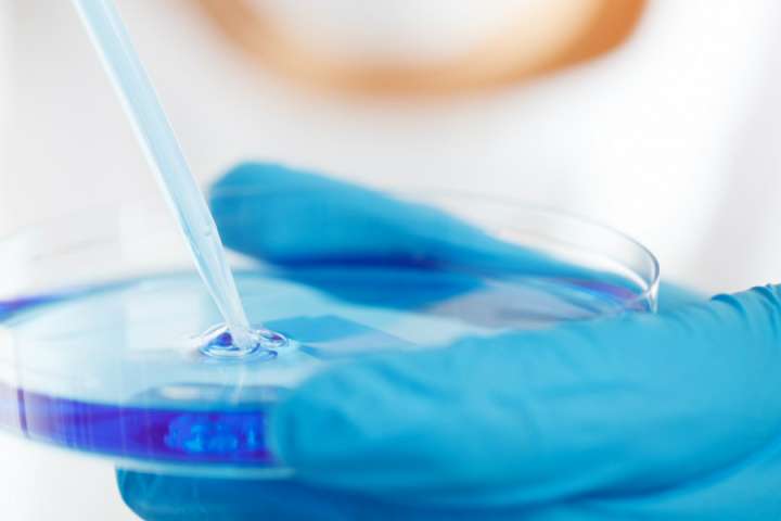 Brain cells grown in a dish shed light on genetic origins of ...