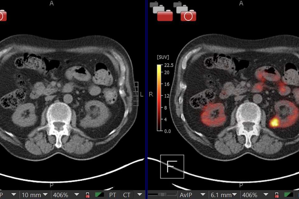Department of UCLA Urology | UCLA Health
